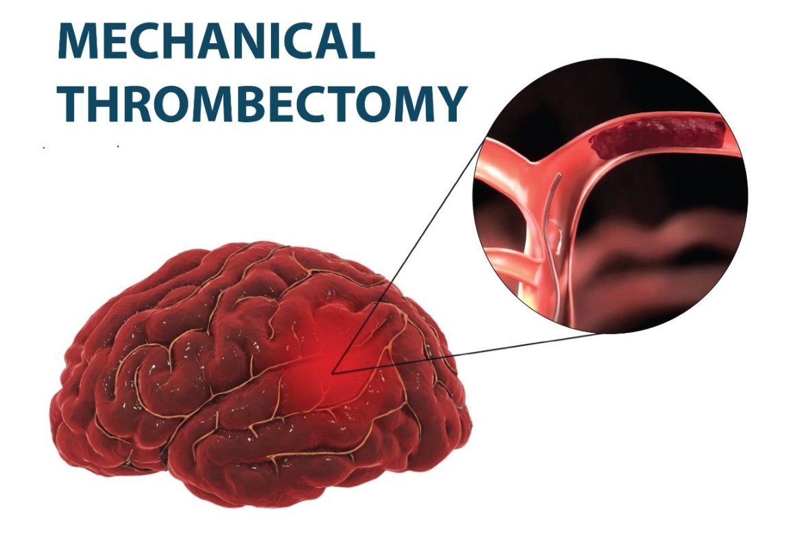 Interventional Radiology and Vascular excellency in North karnataka